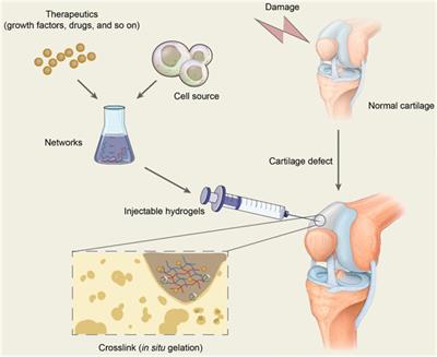 Cartilage Tissue Diagram